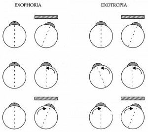 » Single cover testCanadian Neuro-ophthalmology Group