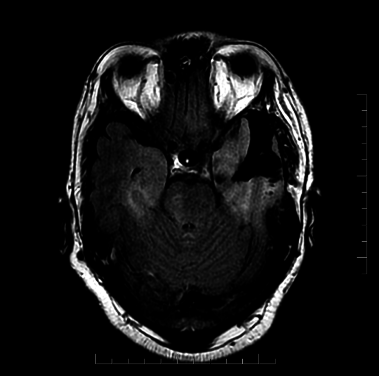 » La balade des yeuxCanadian Neuro-ophthalmology Group