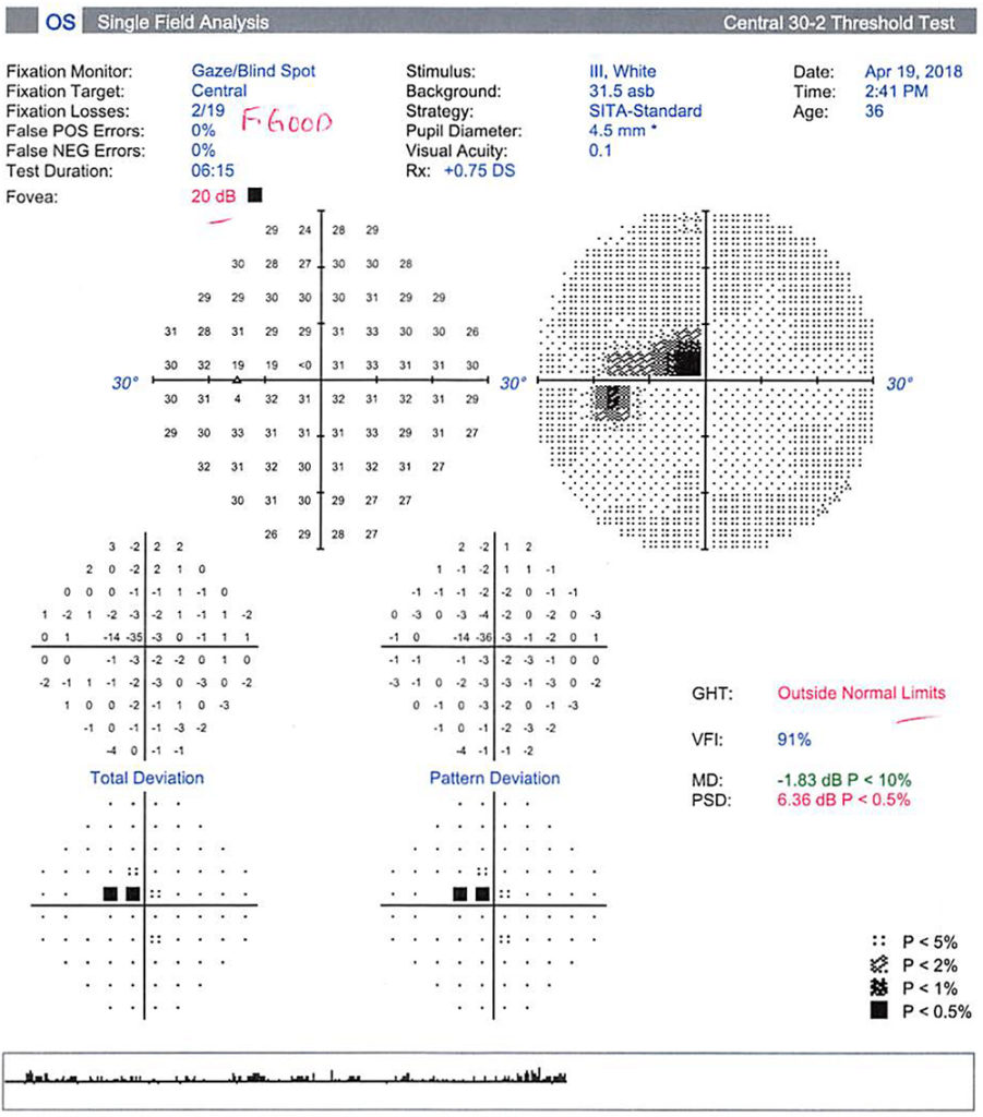 » The hole in the middleCanadian Neuro-ophthalmology Group