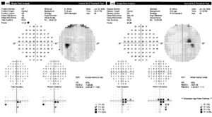 » One thing after another…Canadian Neuro-ophthalmology Group