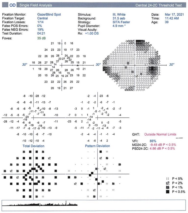 » Blow-upCanadian Neuro-ophthalmology Group