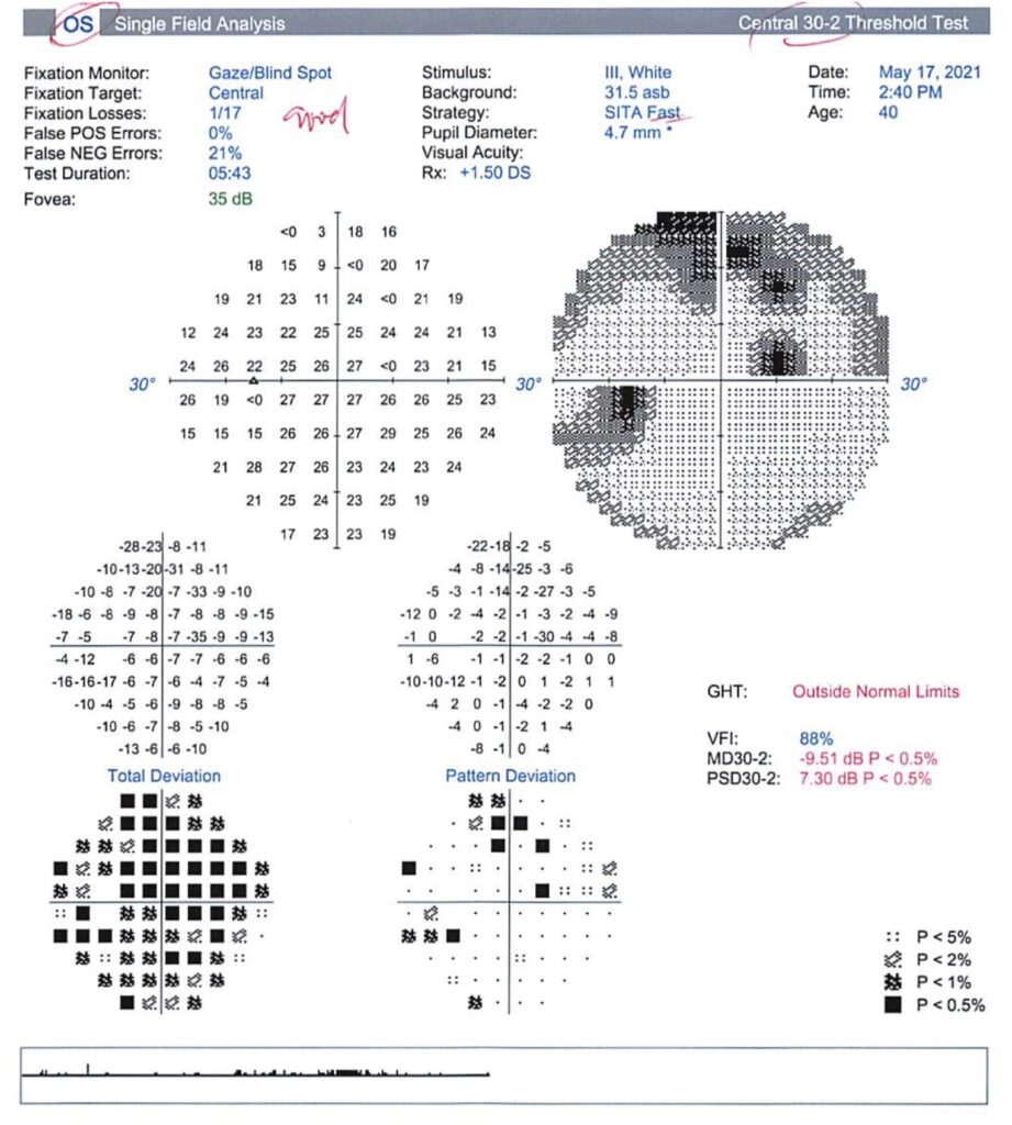 » Blow-upCanadian Neuro-ophthalmology Group