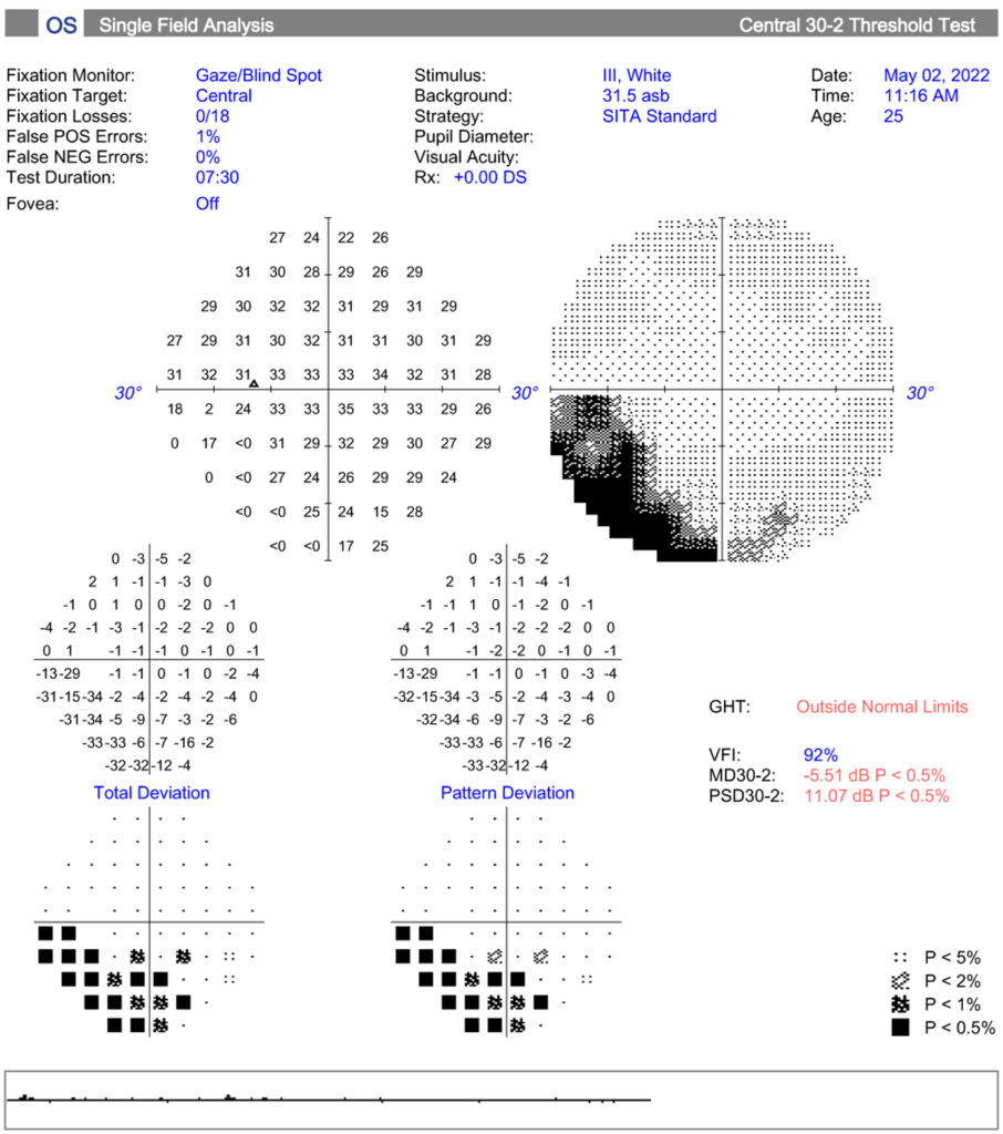 » Driving with the top downCanadian Neuro-ophthalmology Group