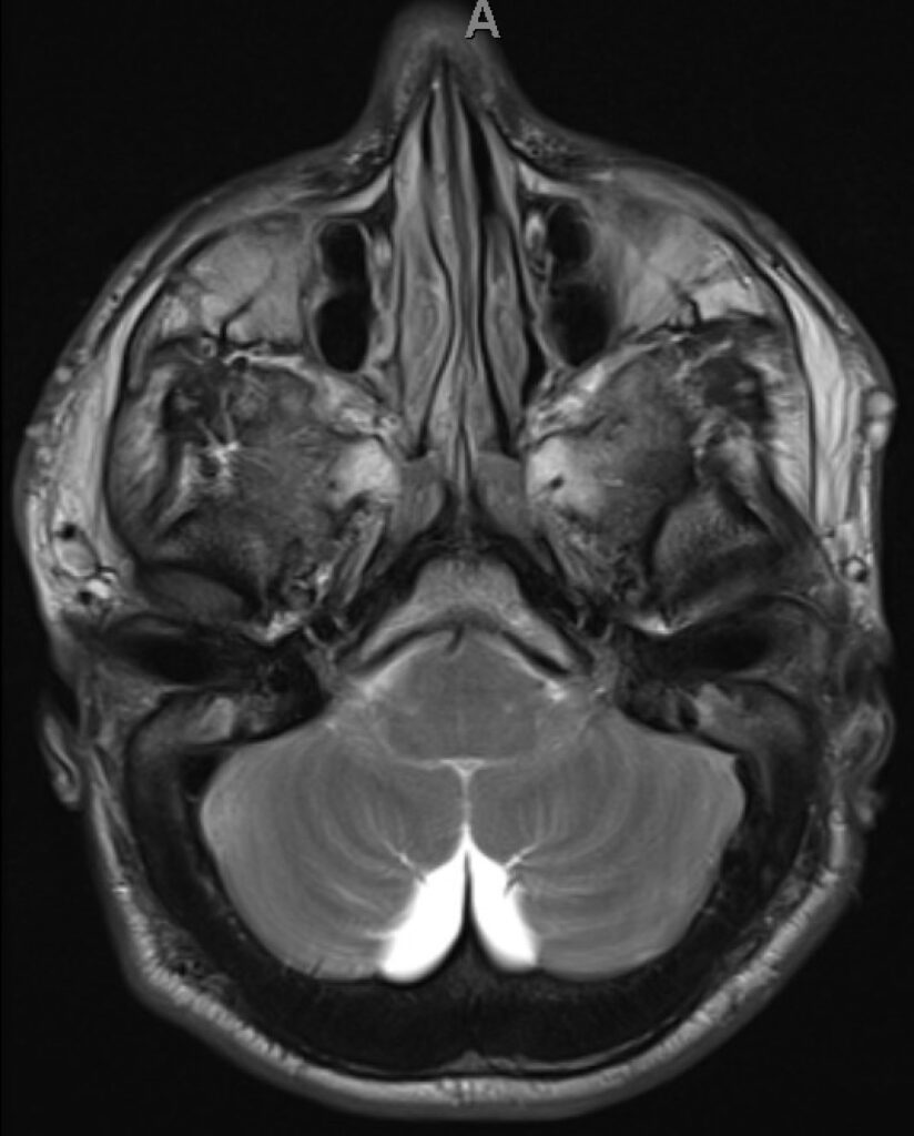 » The alpha maleCanadian Neuro-ophthalmology Group